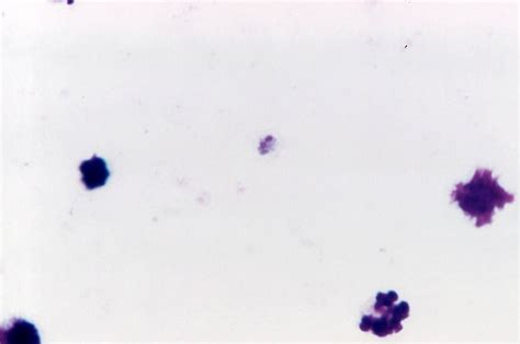 Free Picture Magnified X Thin Film Photomicrograph Blood