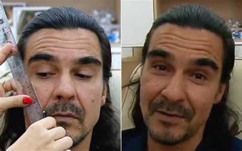 André Gonçalves faz harmonização para voltar a ser galã veja antes e