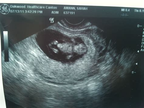 Free Printable Ultrasound Worksheets