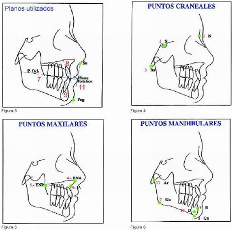 Sistema cefalométrico Olmos básico Gaceta Dental