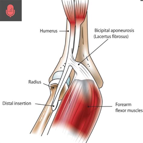 Radial Tuberosity Biceps