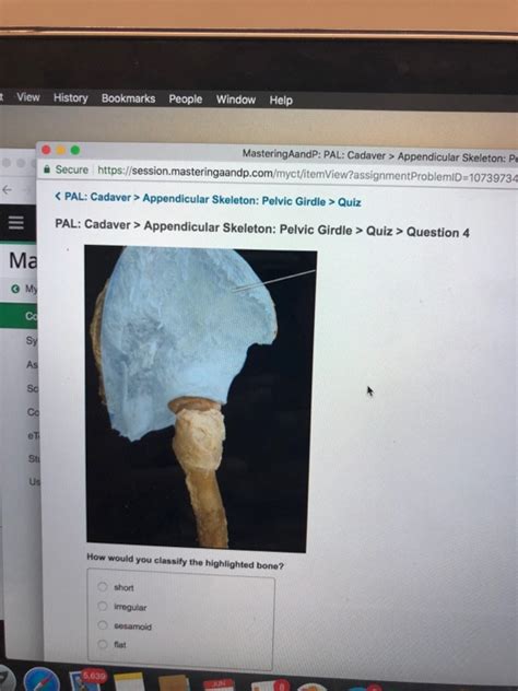 Solved Al Cadaver Appendicular Skeleton Pelvic Girdle Chegg