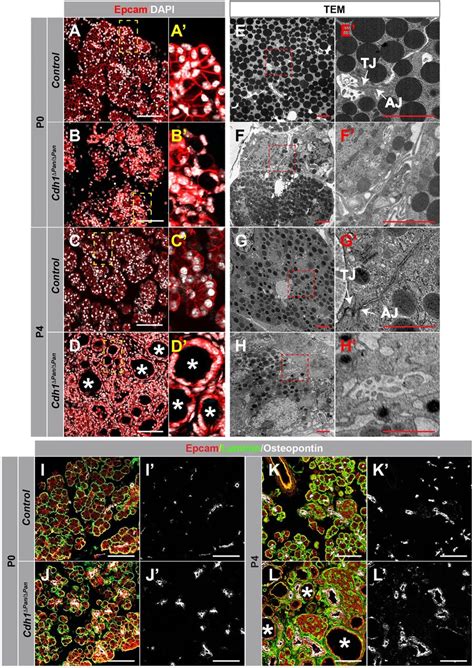 Impairment Of Adherens Junctions And Disrupted Exocrine Tissue