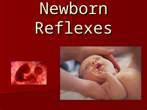 Ppt Newborn Reflexes What Is A Newborn Reflex Newborn Reflexes Are Reflex Actions