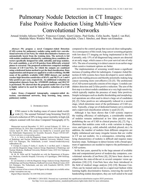 pdf pulmonary nodule detection and segmentation using