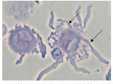 dendritic cell microscope