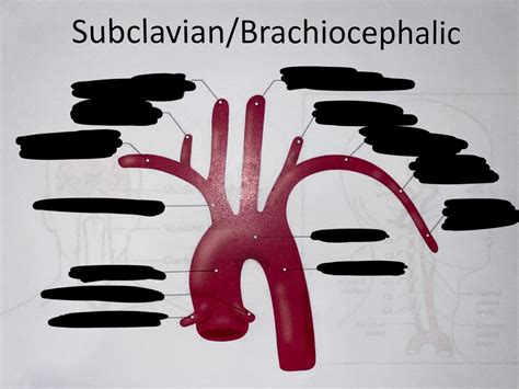 Subclavian Brachiocephalic Diagram Quizlet