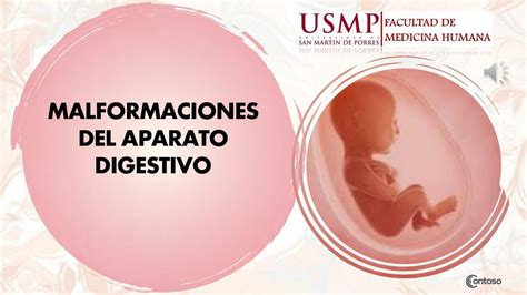 Malformaciones Del Aparato Digestivo Tiroxina Med Udocz