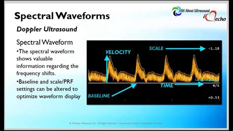 Doppler Principles Spectral Analysis Youtube