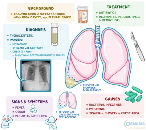 What Causes Empyema 40 OFF Gbu Presnenskij Ru