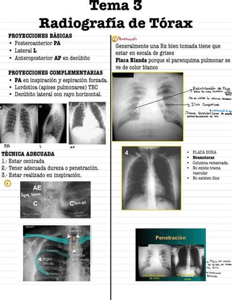 Radiografía de Tórax GABY MARIA VIEIRA MORALES uDocz