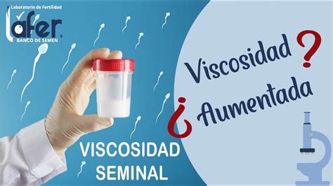 Viscosidad Del Semen Youtube