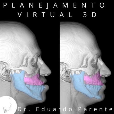 Cirurgia Ortogn Tica Dr Eduardo Parente