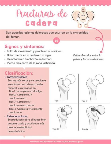Cuadro Resumen De Fractura De Cadera Udocz The Best Porn Website