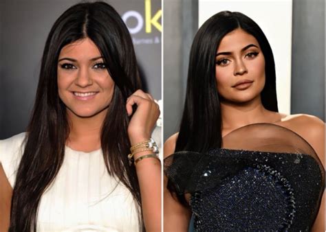 These Before And After Photos Of Kylie Jenner Will Have You Doing A Double Take Celebrity Insider