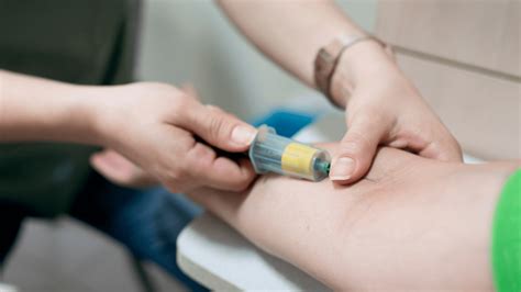 Tout Savoir Sur Le Pr L Vement Veineux Avf Biomedical