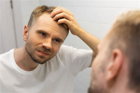 Perte De Cheveux Homme Mieux La Comprendre Men S Shampoo