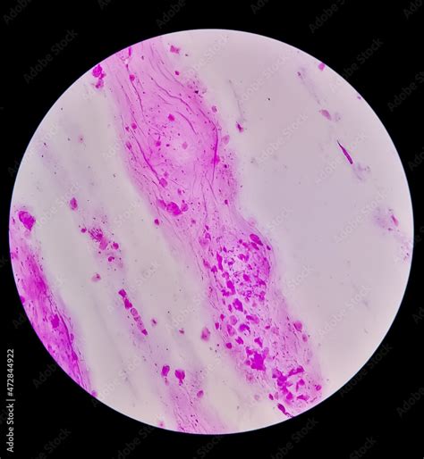 Gram Staining Also Called Gram S Method Is A Method Of