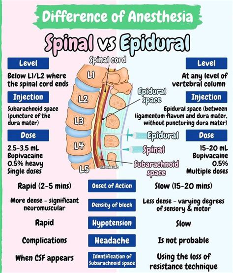 Spinal Vs Epidural MEDizzy