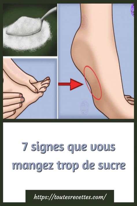 7 Signes Que Vous Mangez Trop De Sucre Toutes Recettes