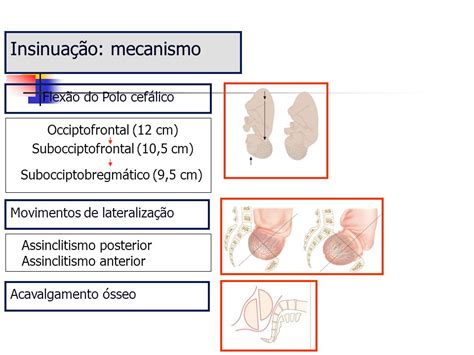 Mecanismo De Parto Na Apresenta O Cef Lica Fletida Ppt Video Online