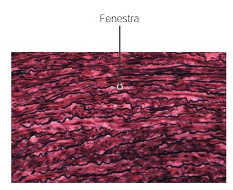 Arterien Aufbau Und Arten Histologie Lecturio