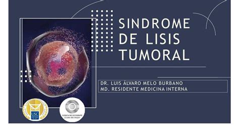 Síndrome de Lisis Tumoral Henry Maldonado Gutiérrez uDocz