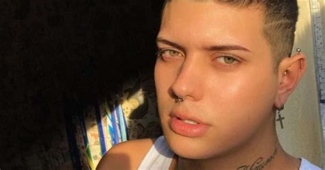 Jovem Morre 24 Dias Depois De Ser Baleado Na Nuca Ao Tentar Separar