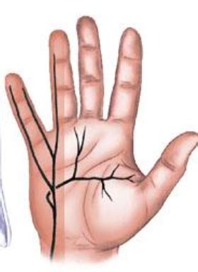 Nerve Injury Flashcards Quizlet