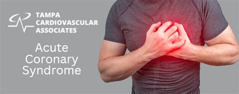 Cardiologist Tampa Fl Heart Doctor Vascular Surgeons Varicose