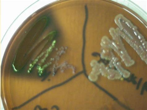 Microbiology Lab Final Flashcards Quizlet