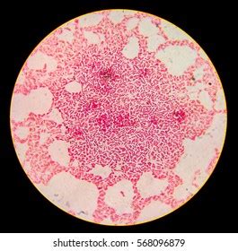 E Coli Gram Stain X