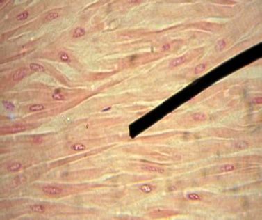 Muscle Tissue Flashcards Quizlet