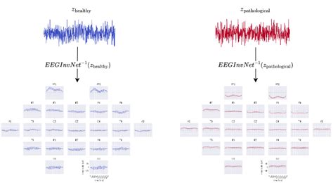 invertible networks — deep learning for brain signal decoding from electroencephalography eeg