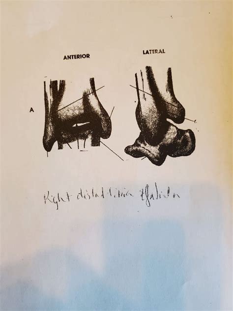 Distal Tib Fib Diagram Quizlet