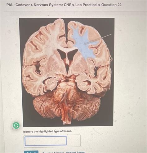 Solved PAL Cadaver Nervous System CNS Lab Practical Chegg