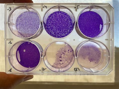 Respiratory Syncytial Virus Plaque Assay ResearchGate
