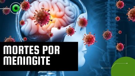 Meningite Quais S O Os Tipos E Como Evitar O Cont Gio Youtube
