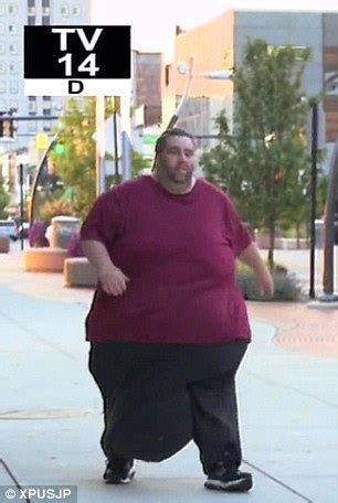 Dan Maurer With 80lb Scrotum Has 14 Hour Surgery To Remove The Giant