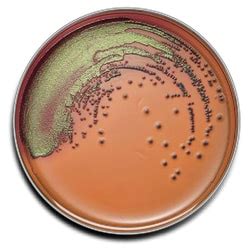 BD BBL Prepared Plated Media Levine EMB Agar Levine EMB Agar 100 Pk