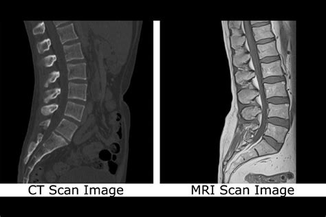 Trastorno F Cil De Leer Plan Diferencia Entre Escaner Y Radiografia