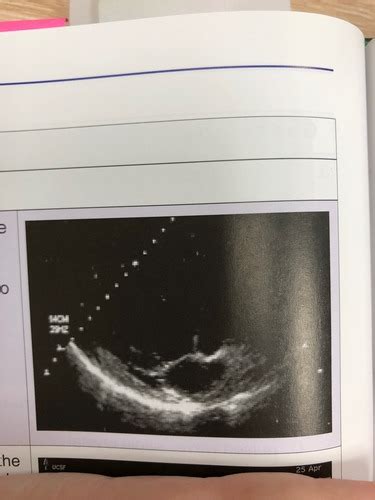 UNDERSTANDING ULTRASOUND PHYSICS FINAL Flashcards Quizlet