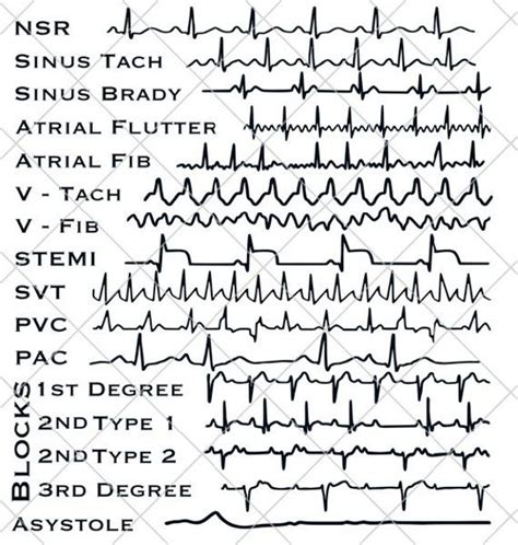 EKG Strips SVG Cardiac Monitor Nurse Technician Doctor Gift Digital