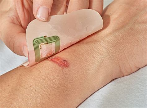 Wound Care Monitoring