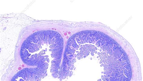 Duodenum Light Micrograph Stock Image C051 7266 Science Photo