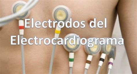 Electrocardiograma Cerebromedico