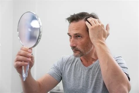 Perte De Cheveux Chez Les Hommes Principales Causes Et Facteurs De Risques