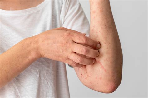 7 possíveis causas das bolinhas no braço