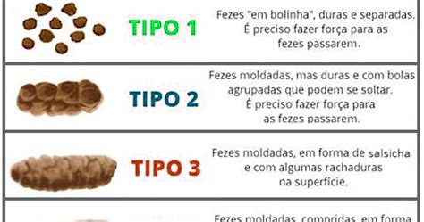 Como S O As Tuas Fezes