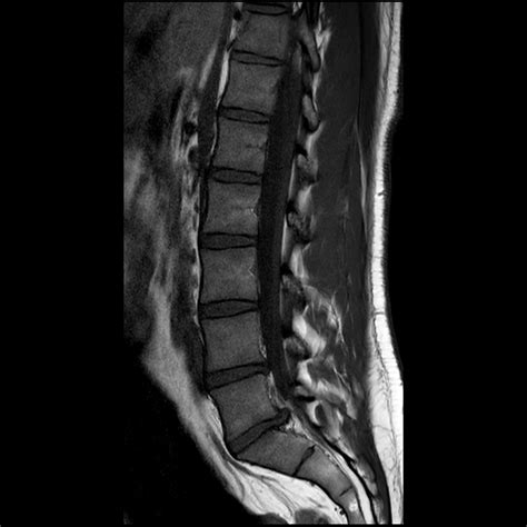 Image Radiopaedia Org